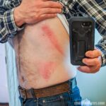 Table Saw Kickback (Cause, Injuries & How to Avoid It) | Saws on Skates®